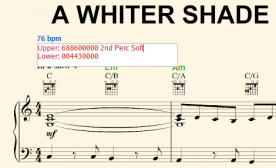 MusicRack – A Digital Sheet Music Display System